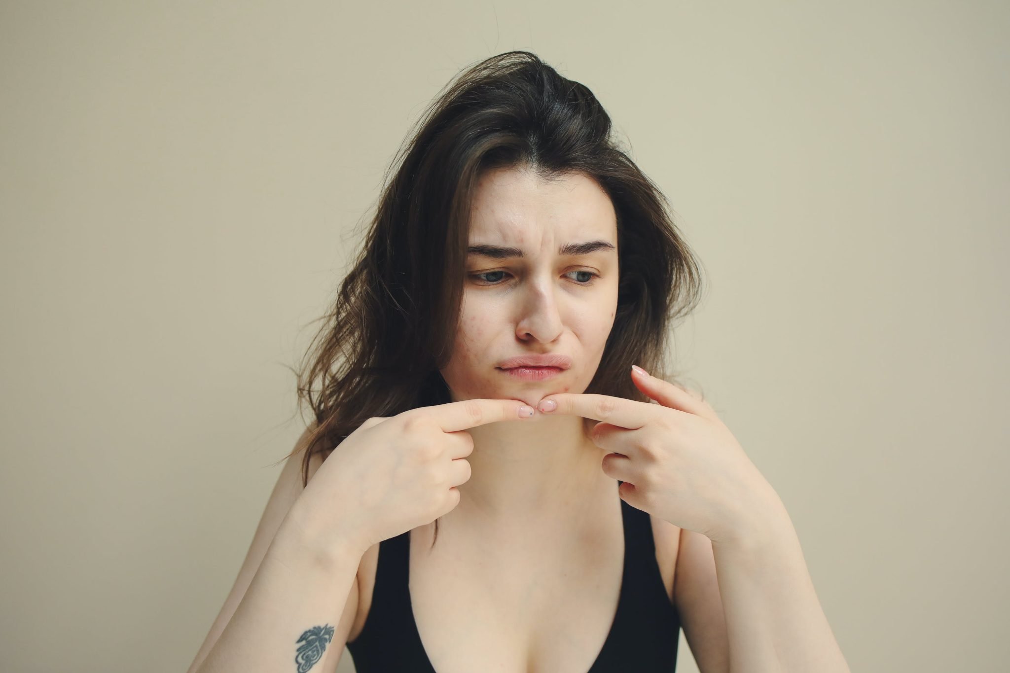 Dealing with Perimenopausal Acne: Understanding Causes and Finding ...