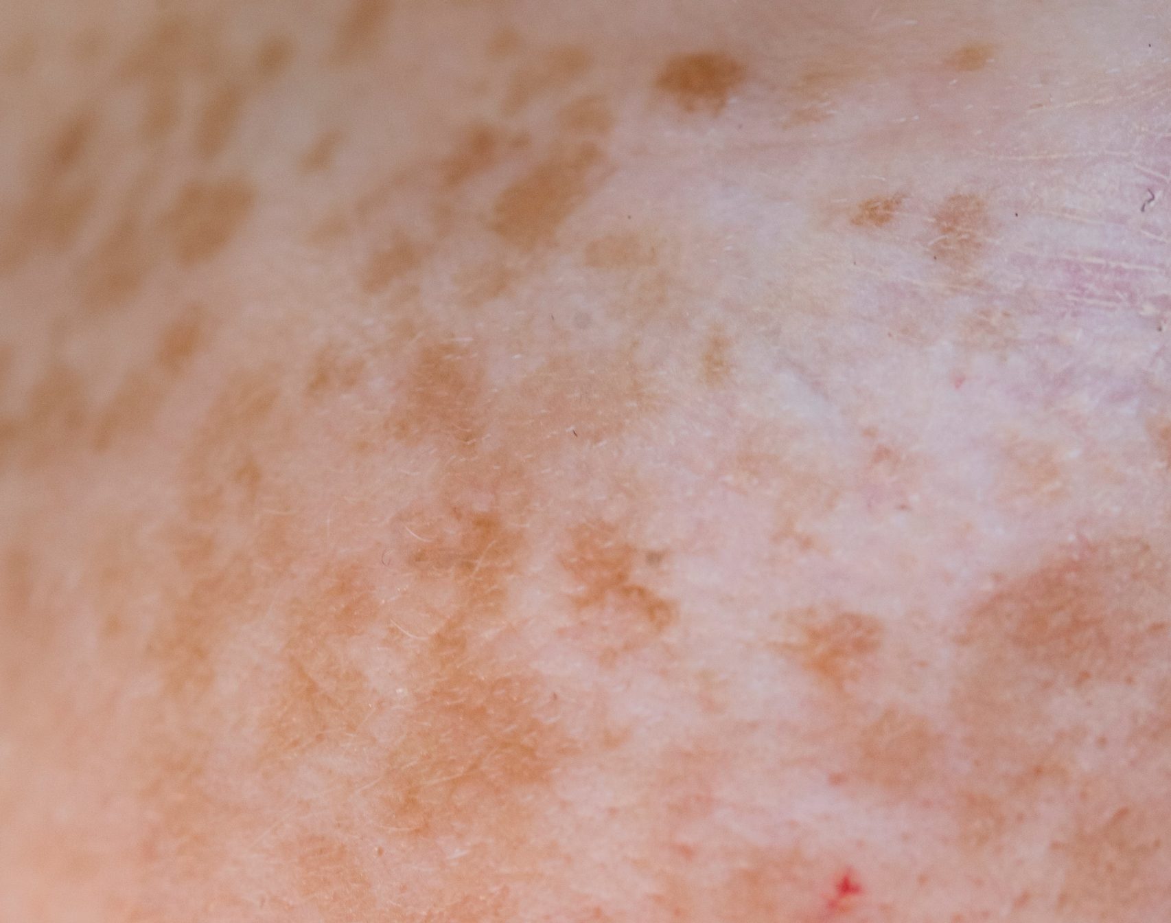 Our Best Tips for Caring for Skin in Perimenopause - This Is Perimenopause