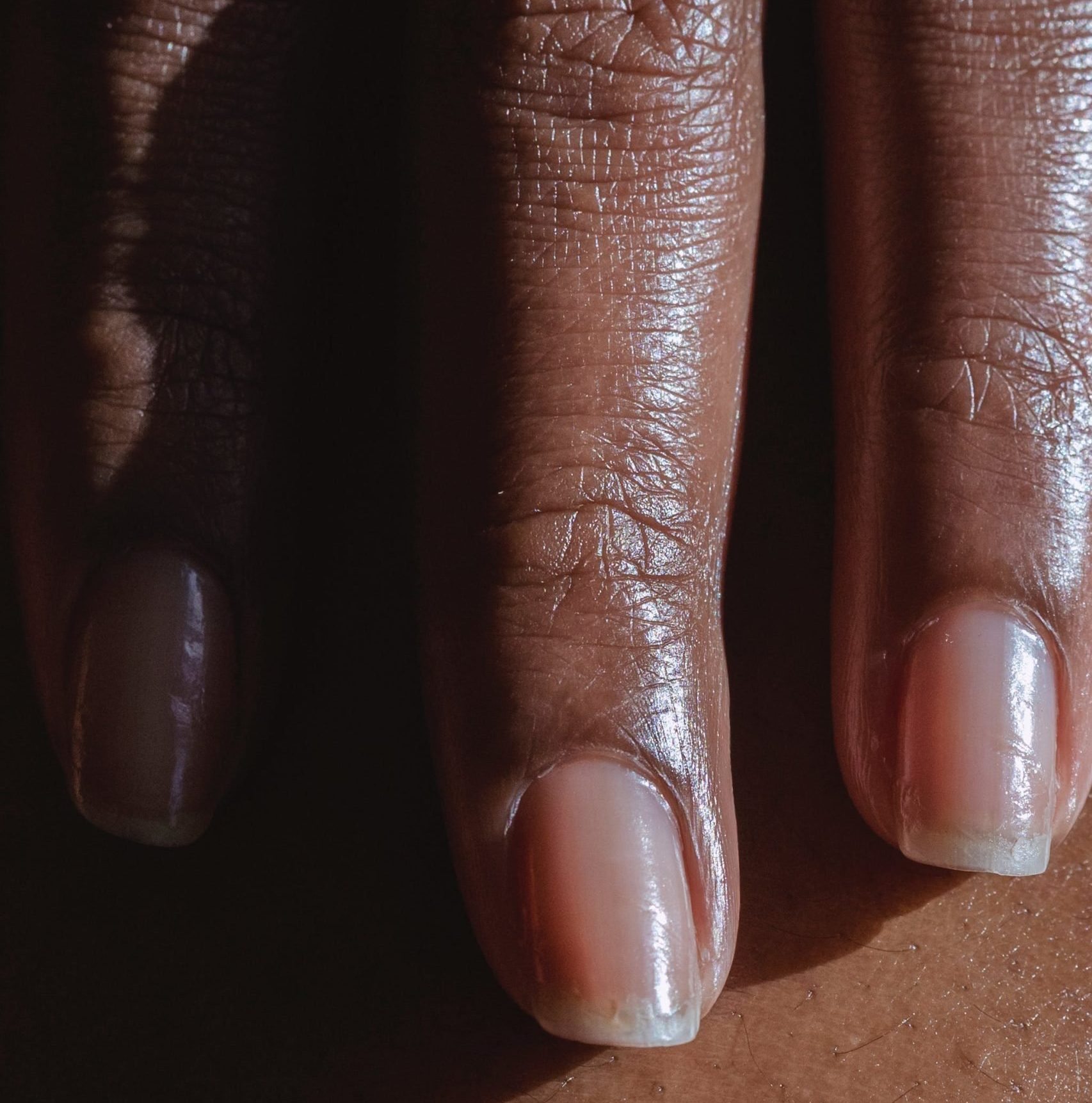 The Unusual Suspects: Uncommon Symptoms of Perimenopause - This Is ...