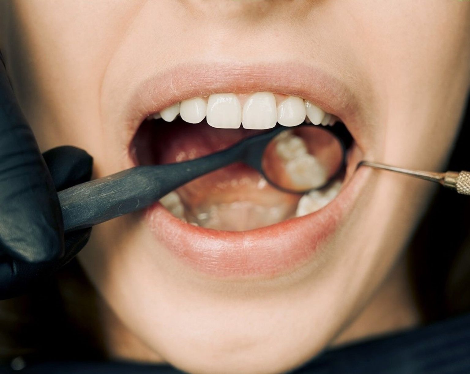 Your Complete Guide to Oral Health and Perimenopause - This Is ...