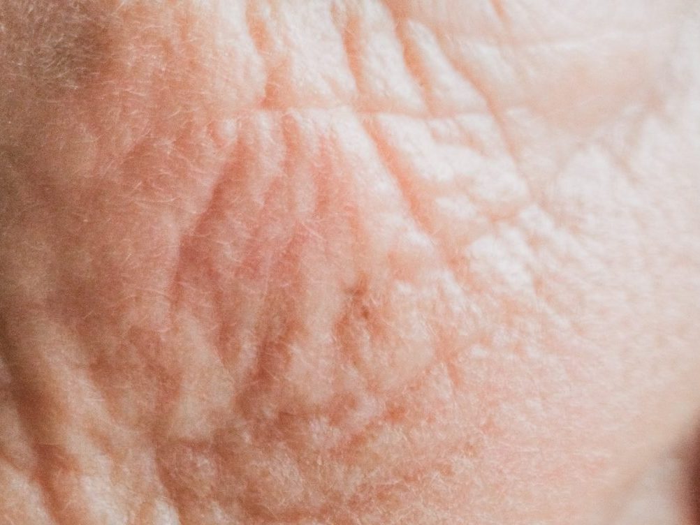Our Best Tips for Caring for Skin in Perimenopause - This Is Perimenopause
